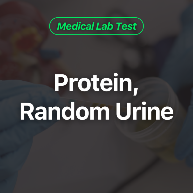 Urine Test Archives - Wittmer Rejuvenation Clinic