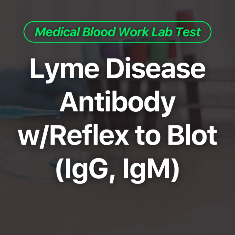 Lyme Disease Antibody w/Reflex to Blot (IgG, IgM) Blood Work Test ...