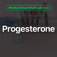 Progesterone Blood Work Test - Wittmer Rejuvenation Clinic